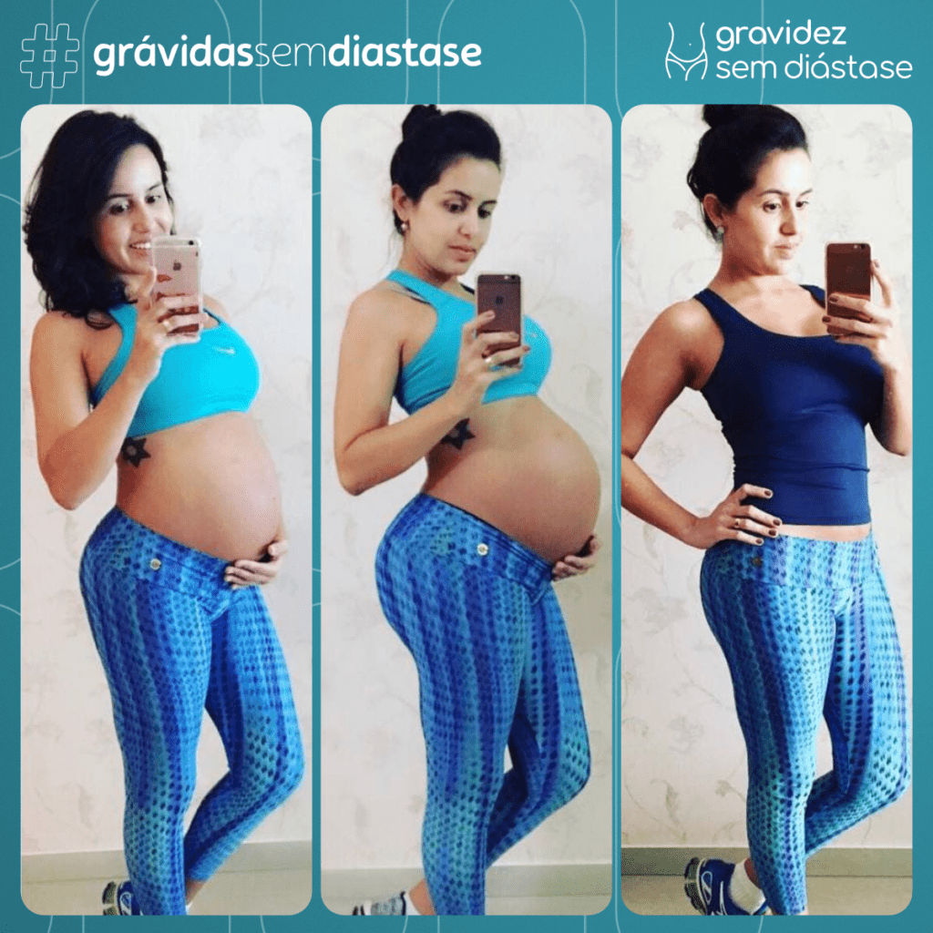 Gravidez sem Diástase - Barriga Reta - ST22 - Gizele Monteiro