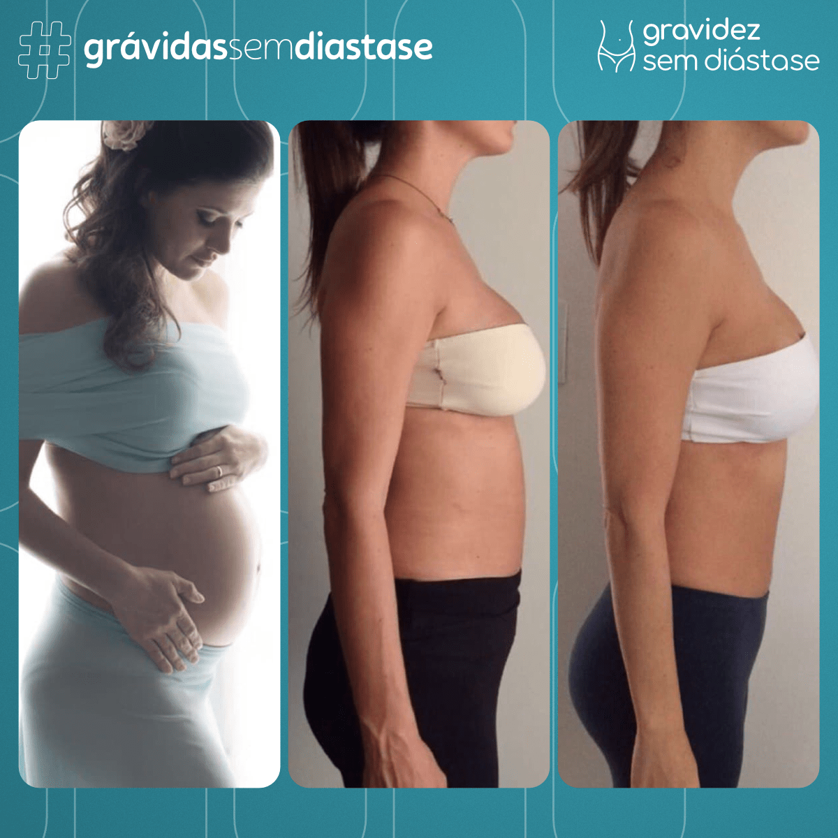 Gravidez sem Diástase - Barriga Reta - ST22 - Gizele Monteiro