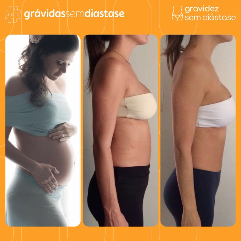 Por que o Programa Mães Sem Diástase é o melhor do mercado?