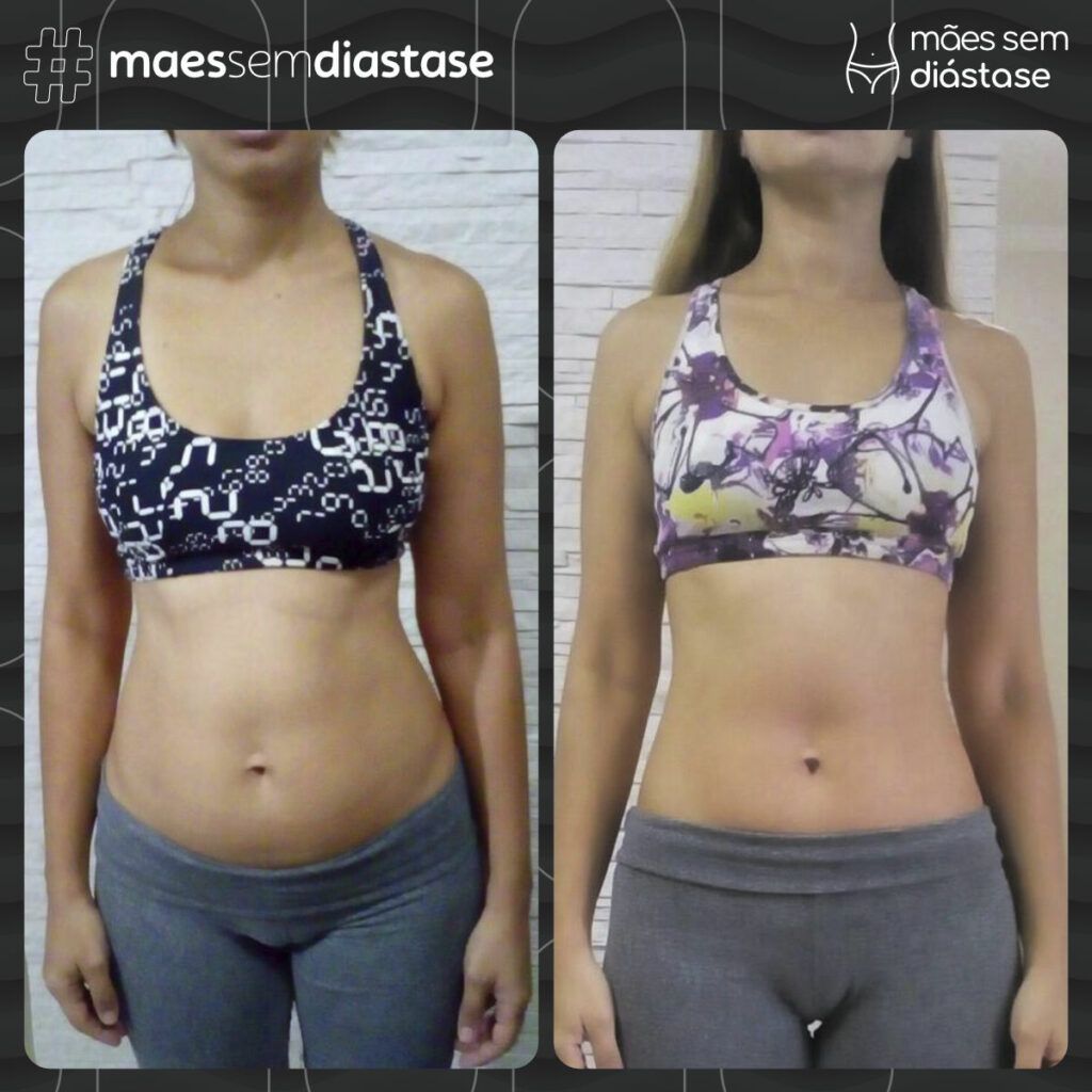 Por que o Programa Mães Sem Diástase é o melhor do mercado?