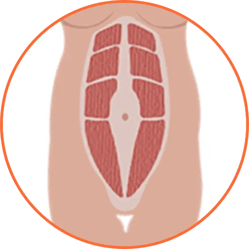 programa-s-o-s-barriga-blog - Gizele Monteiro - Mães sem Diástase