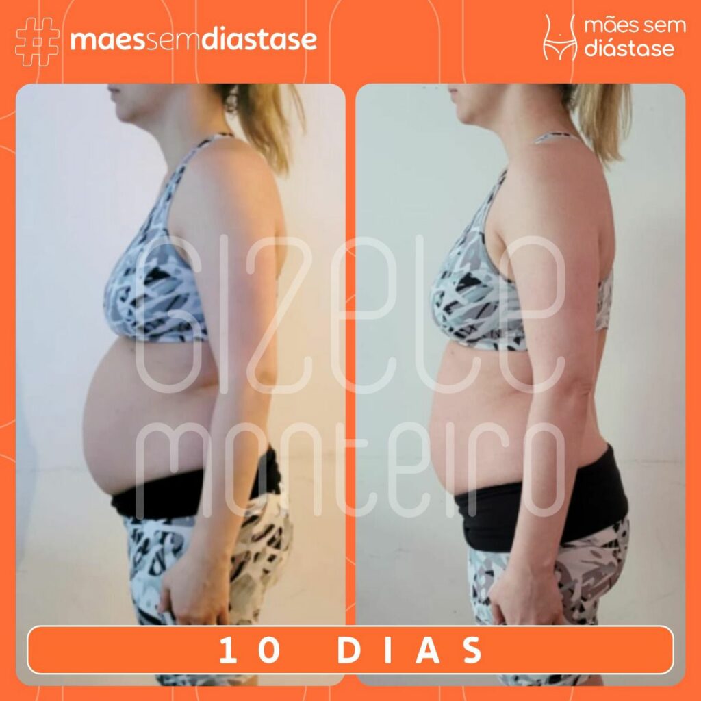 Como está a sua barriga depois do parto? - Gizele Monteiro - Mães sem Diástase